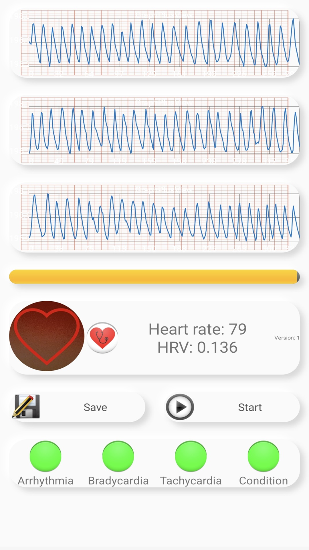 Cardiac Diagnosis - App on Amazon Appstore