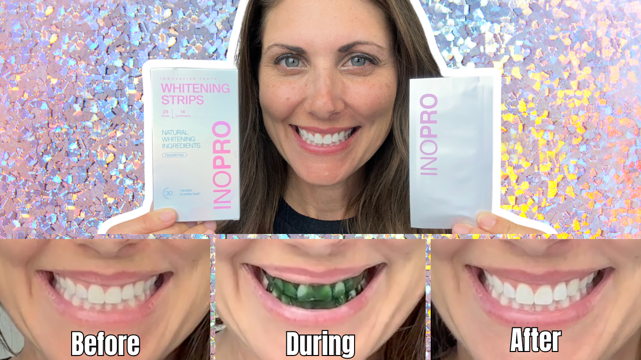 Watch INOPRO Teeth Whitening Strips Tutorial Results After 1 Use on ...