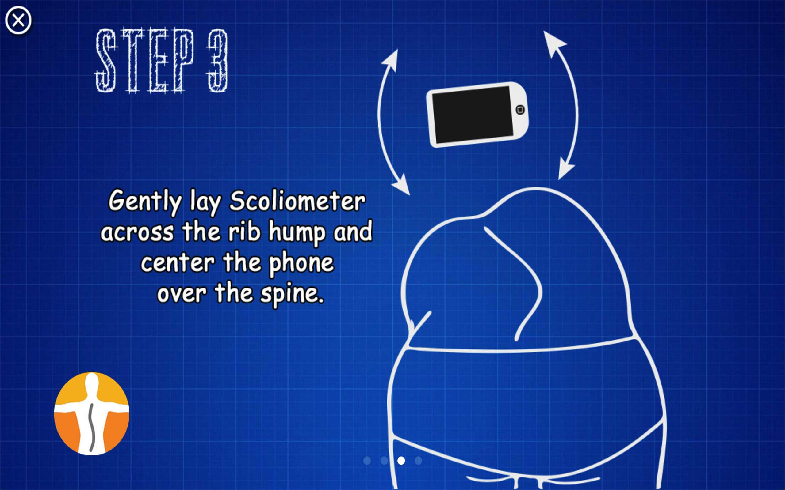 Scoliometer - App on Amazon Appstore