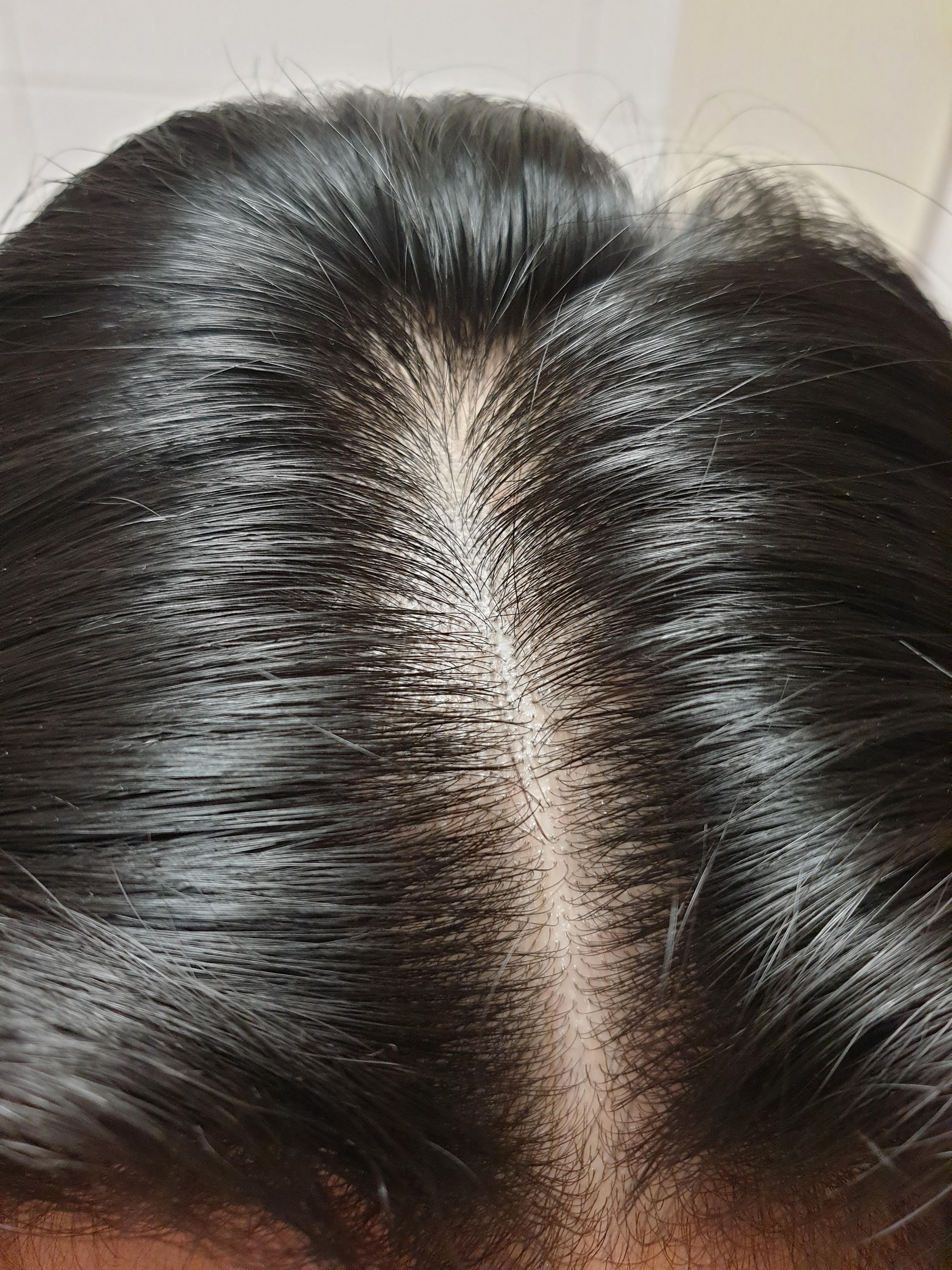 SP Classic Balance Scalp Lotion 125 ml : Amazon.de: Kosmetik