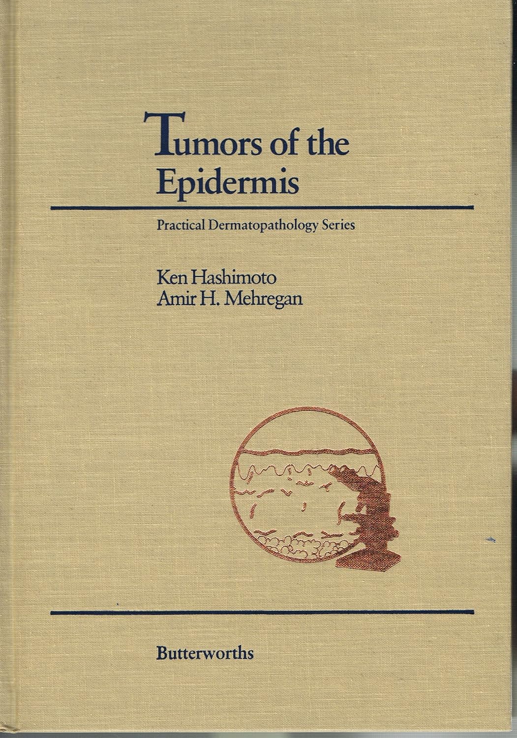 TUMORS OF THE EPIDERMIS (Practical Dermatopathology): 9780409901634 ...