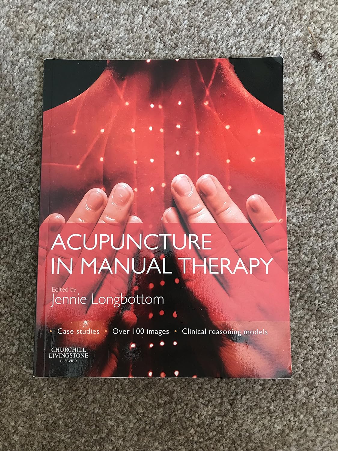 Acupuncture in Manual Therapy: 9780443067822: Medicine & Health Science ...