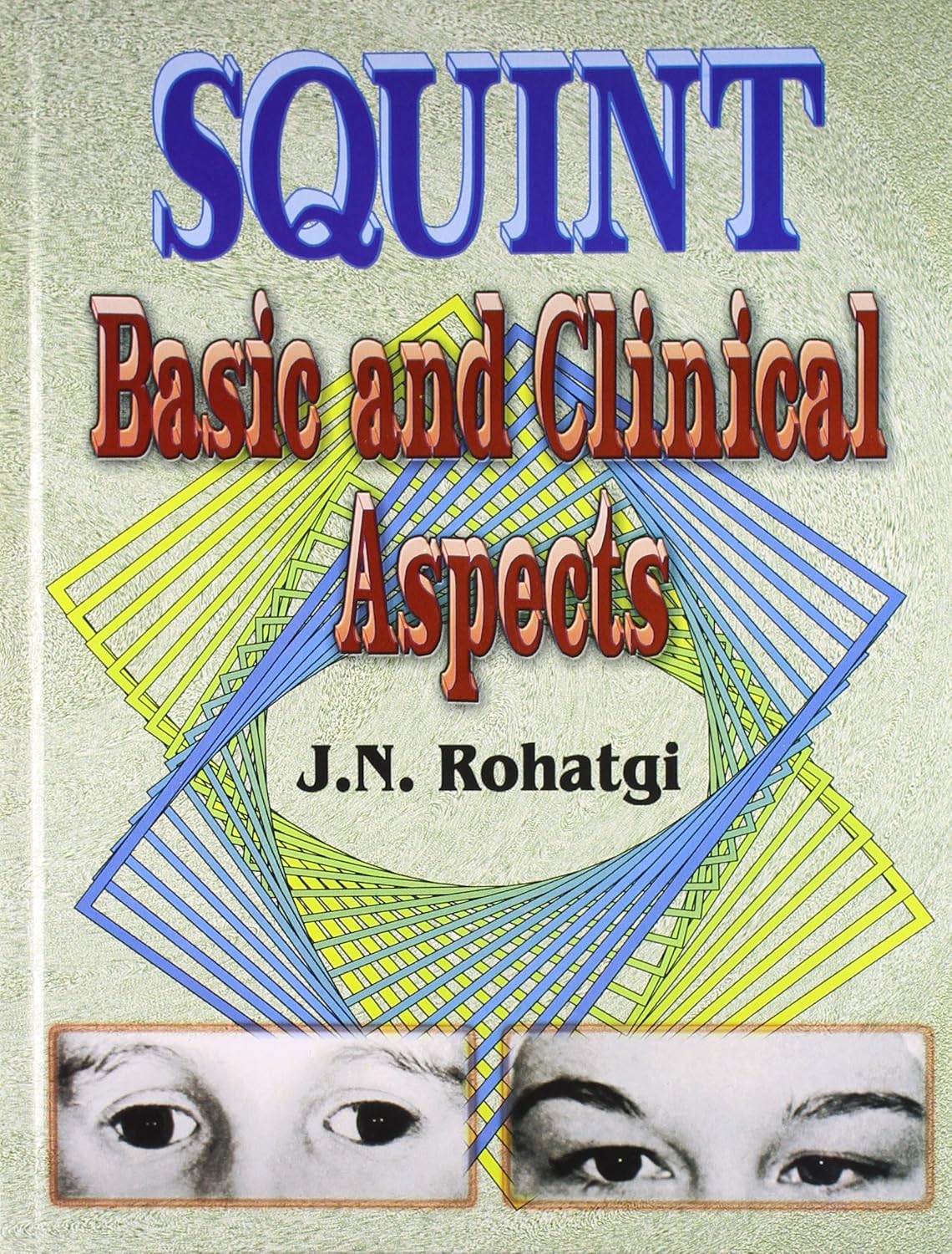 Squint Basic And Clinical Aspects: 9788123909608: Medicine & Health ...
