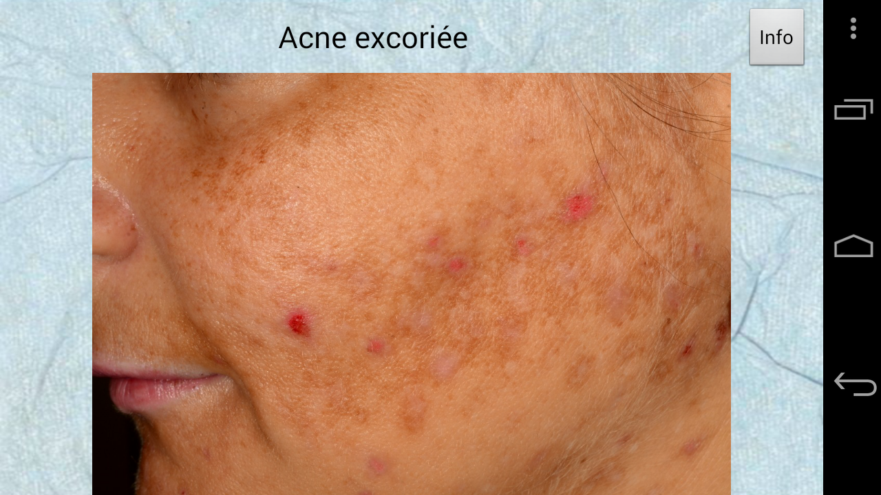 Schiller Dermatologie Die Derma-App! Hautkrankheiten:Amazon.de:Appstore ...