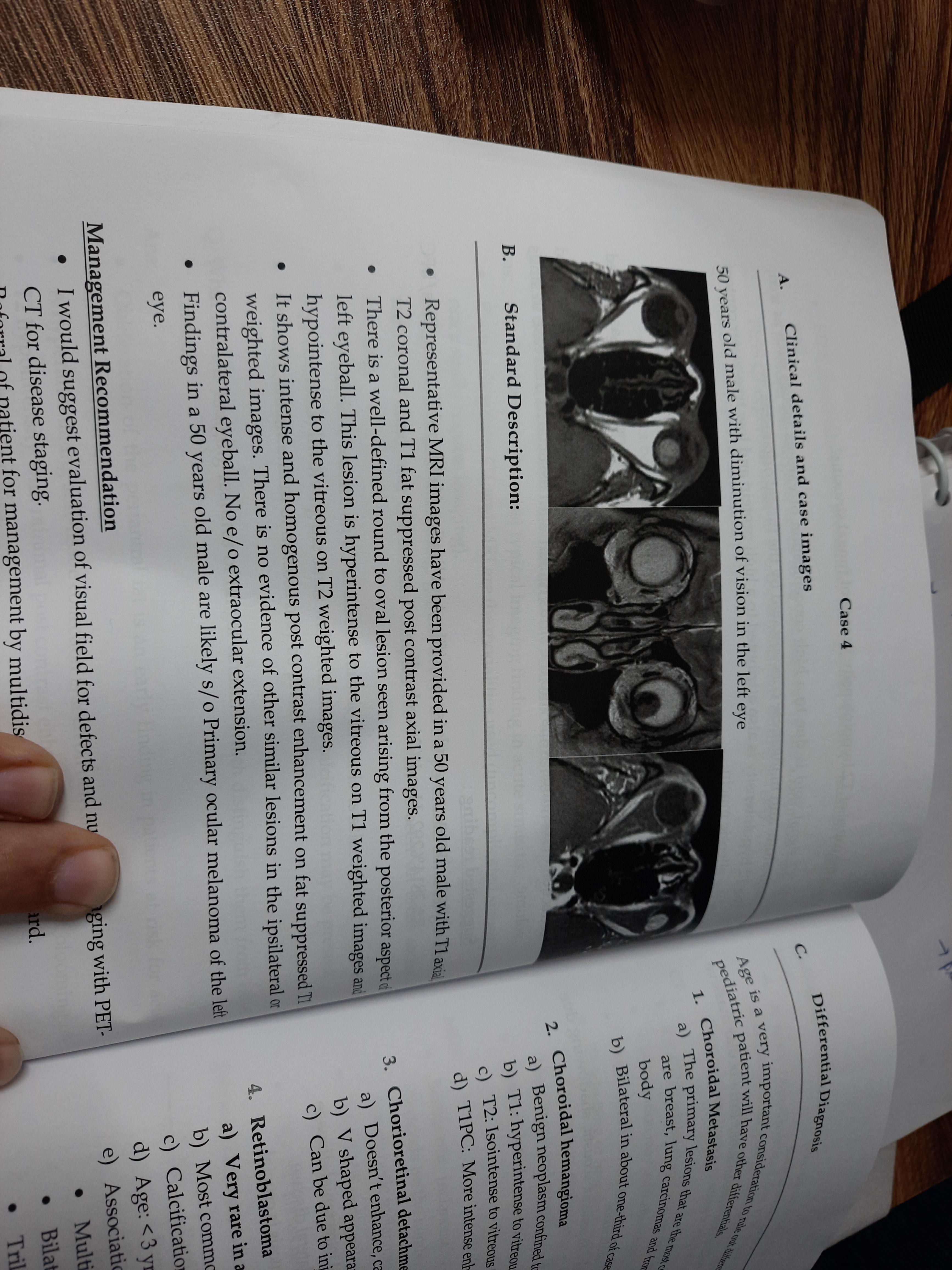 Buy Radiology without tears Volume - II Book Online at Low Prices in ...