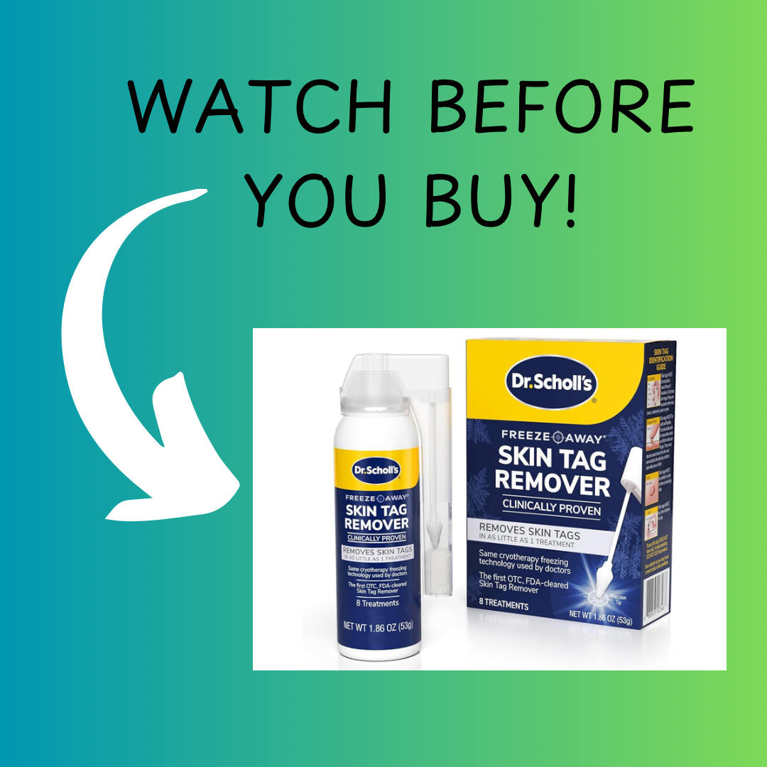 Watch Honest Review of Skin tag removal kit! on Amazon Live