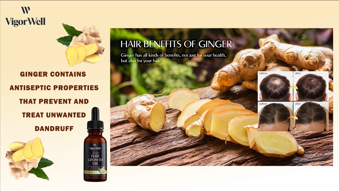 Watch Ginger Hair Serum Ginger Hair Oil VigorWell on Amazon Live