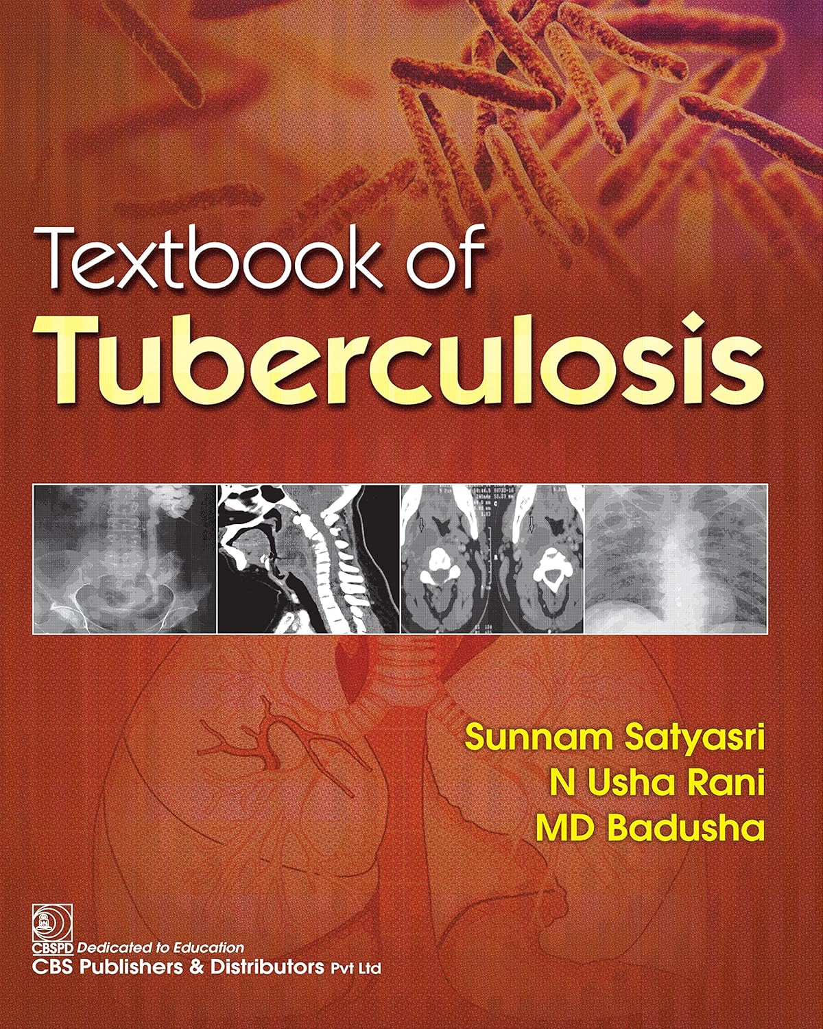 Amazon.com: Textbook of Tuberculosis eBook : Satyasri, Sunnam, Rani, N ...