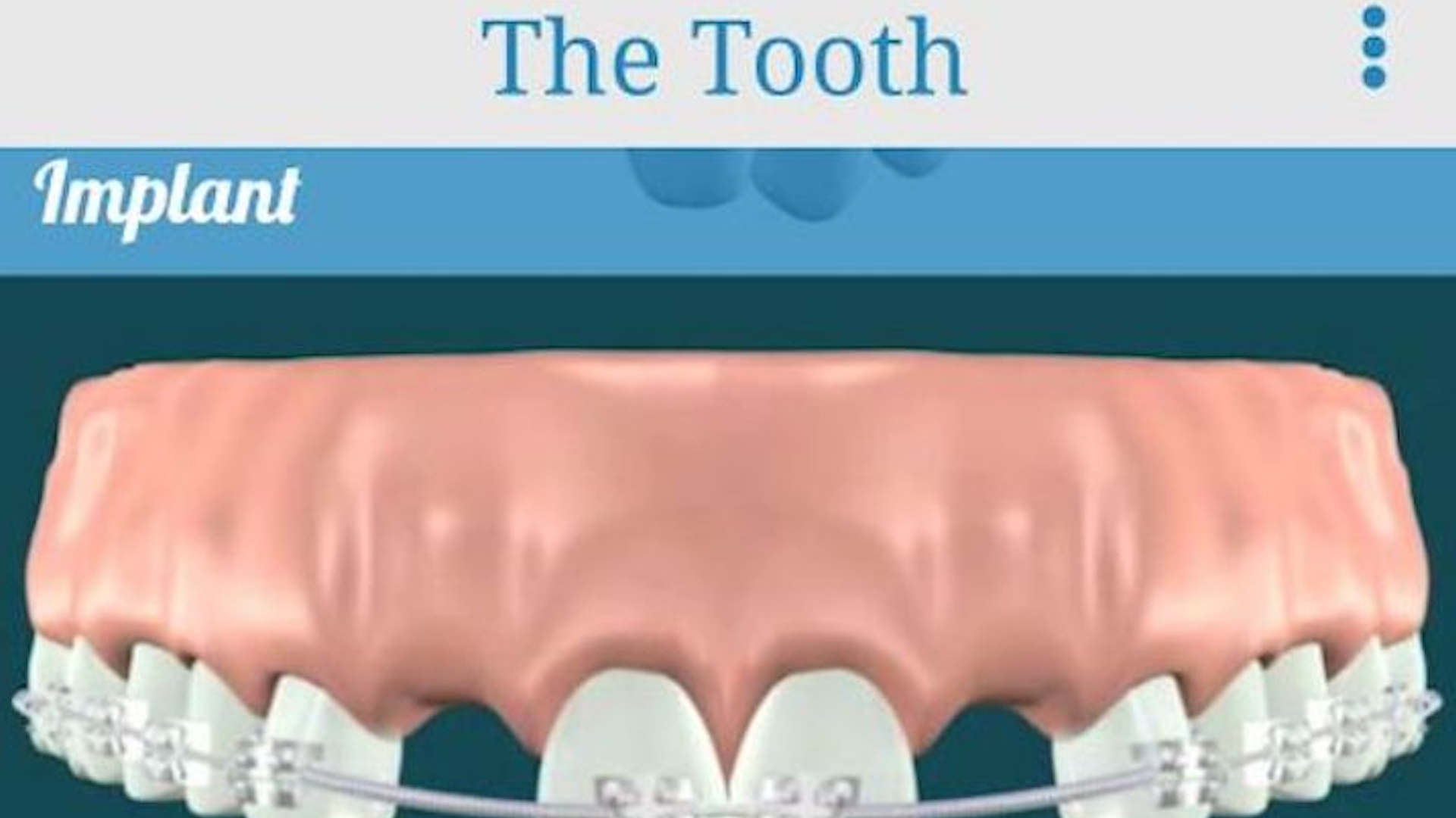 The Tooth Dental Consultation software - App on Amazon Appstore