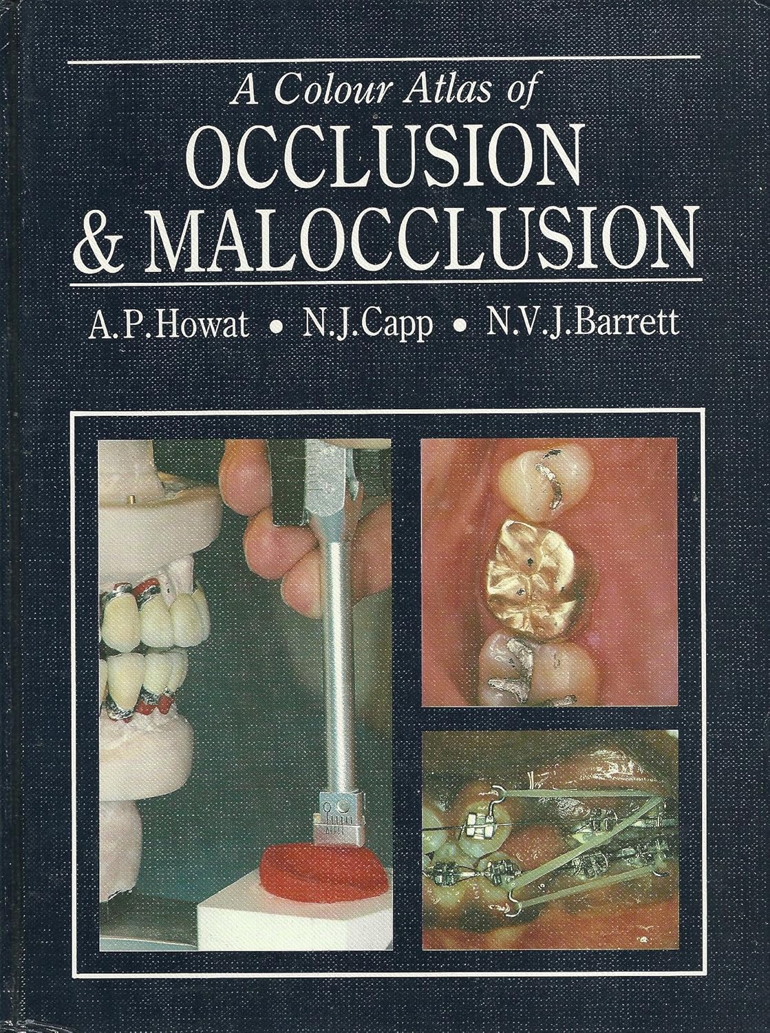 Amazon | A Colour Atlas of Occlusion and Malocclusion | Howat, Alison P ...