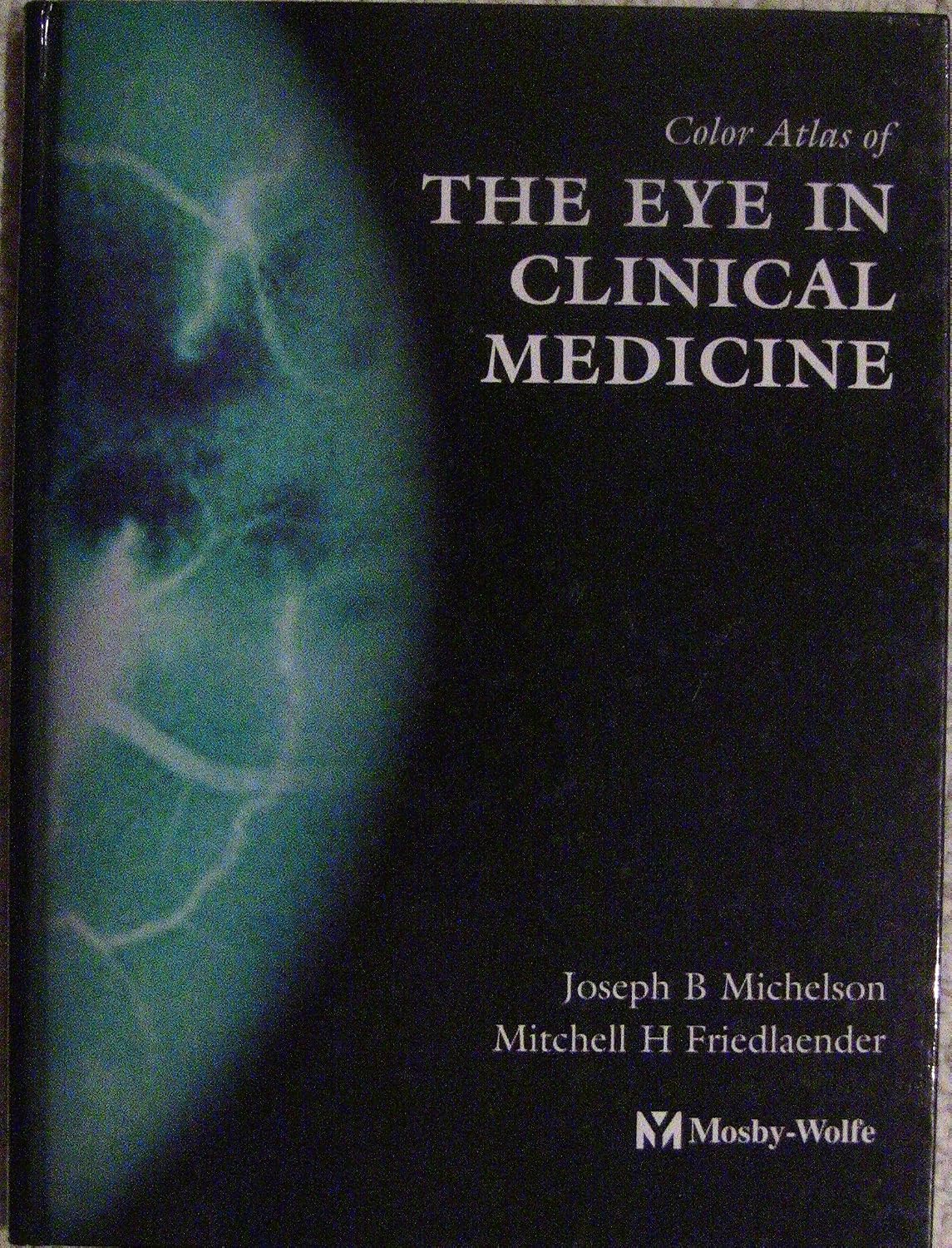 Color Atlas of the Eye in Clinical Medicine | Amazon.com.br