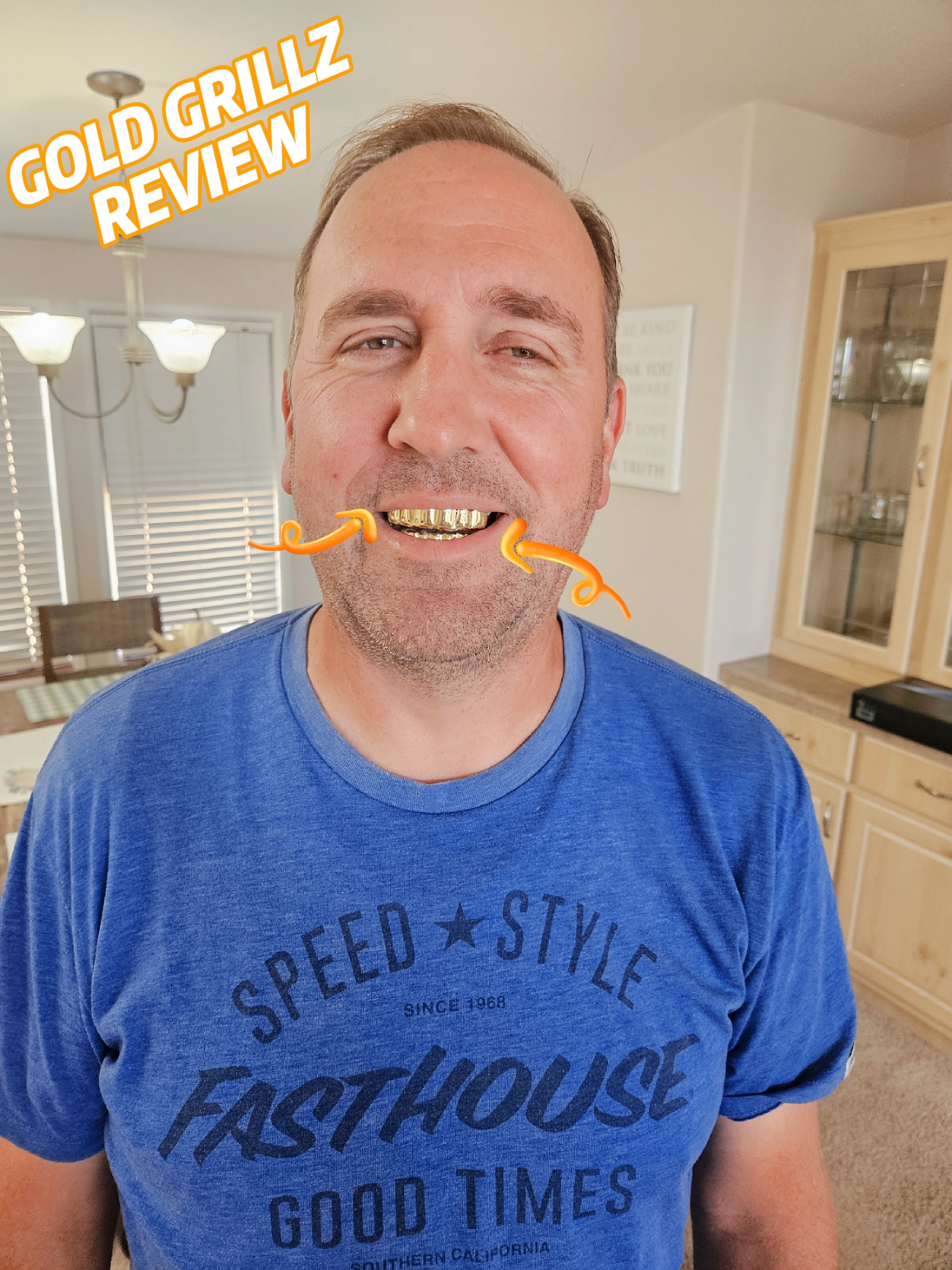 Watch REVIEW-Grillz for Men Gold 6 Teeth Grills Set with Silicone on ...