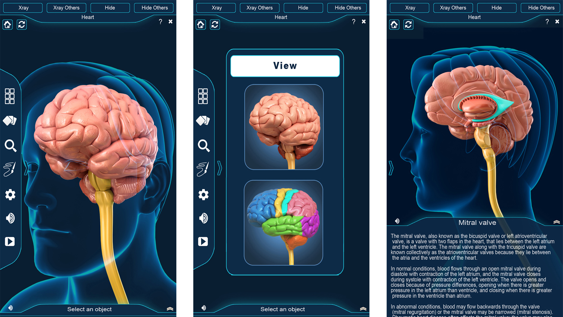 Brain Anatomy Pro. - App on Amazon Appstore