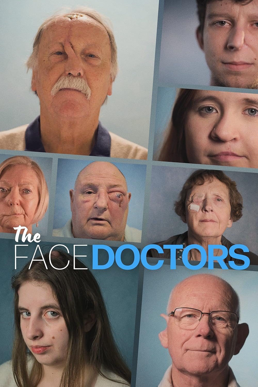 The Face Doctors (TV Series 2024– ) - Episode list - IMDb