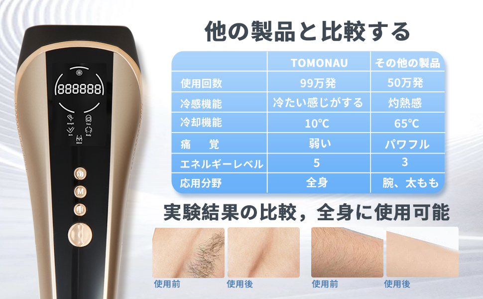 Amazon | TOMONAU 脱毛器 家庭用脱毛器 メンズ レディース 脱毛器vio対応 PSE認証日本正規品 顔 脇 髭 無痛冷感脱毛器 5つの専用モード 5段階調節 手動/自動モード ...