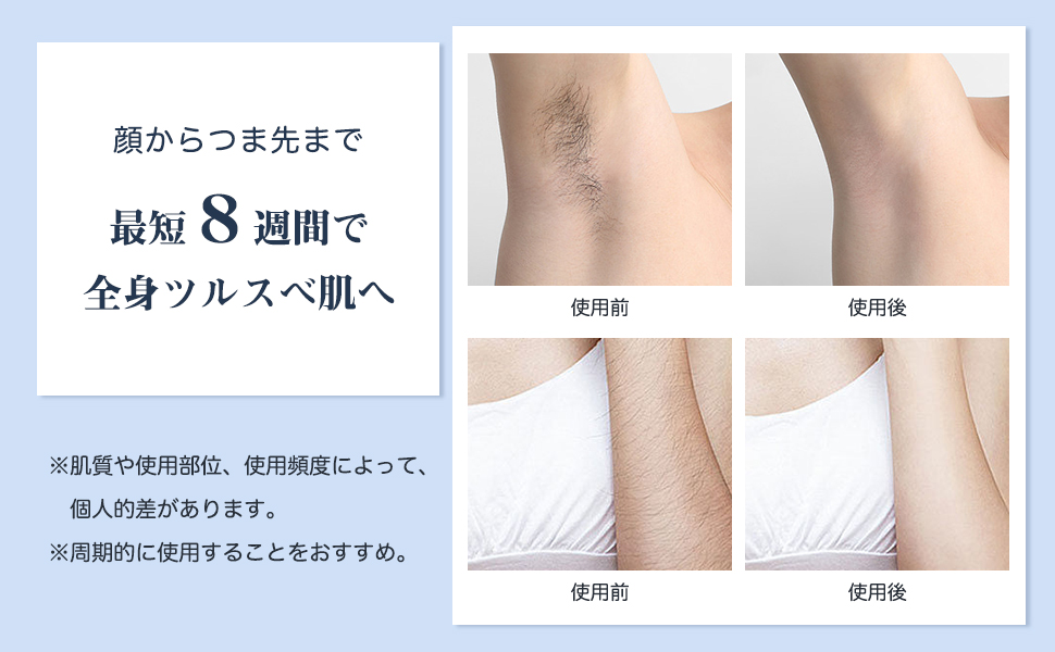 Amazon | 脱毛器 【サロン級・ IPL光脱毛器】 VIO対応 5段階調整 自動/手動照射モード 全身ムダ毛処理 軽量 家庭用 メンズ 男女兼用 家庭用 PSE安全認証済み 日本語説明書 ...