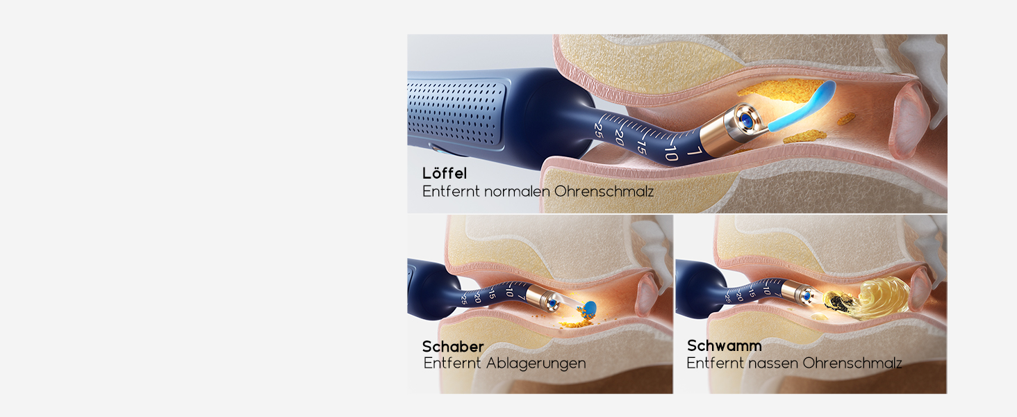 Bebird Ohrenschmalz Entferner Otoskop, 1920P HD Flexibler Ohrreiniger kamera mit Pinzette ...