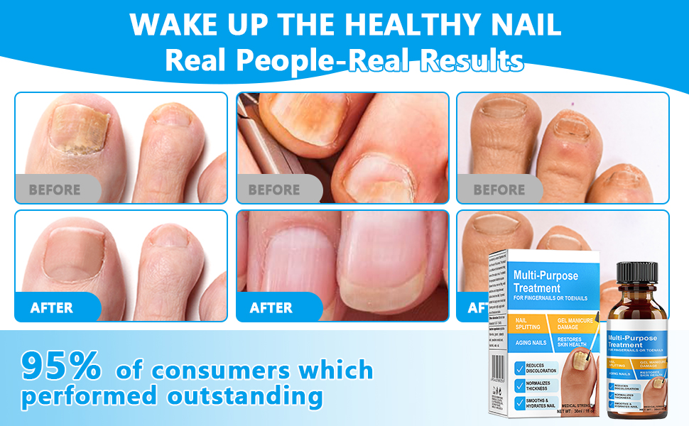 Amazon.com : Toenail Treatment Extra Strength, Toe Nail Treatments for Fingernails, toenail ...