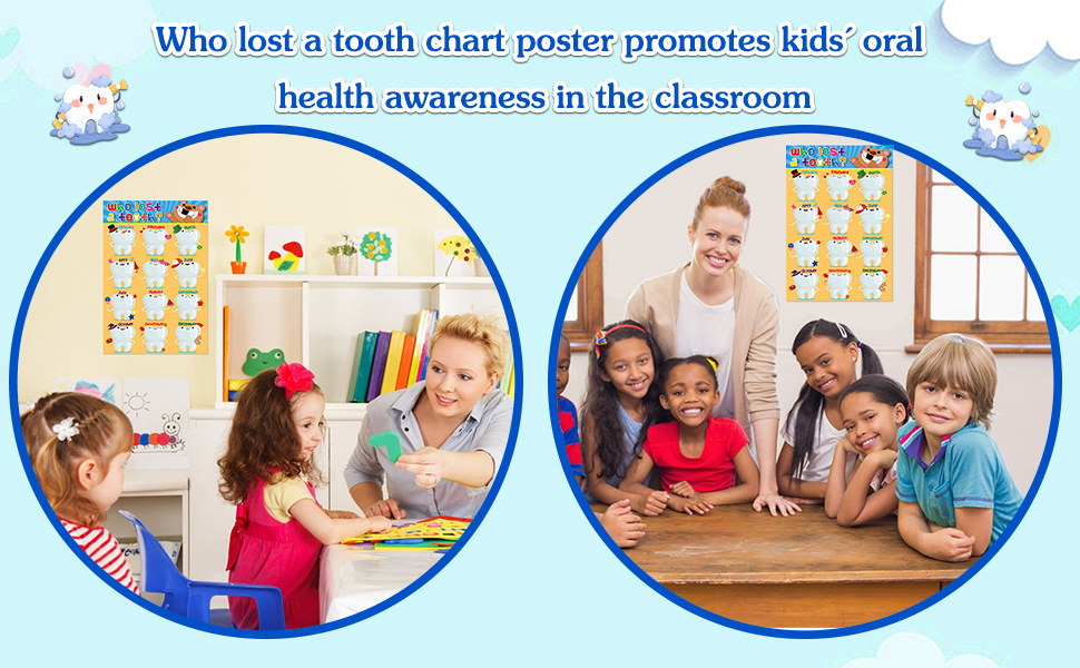 Amazon.com: D4DREAM Who Lost a Tooth Poster Chart 11"x 16.5" Confetti ...