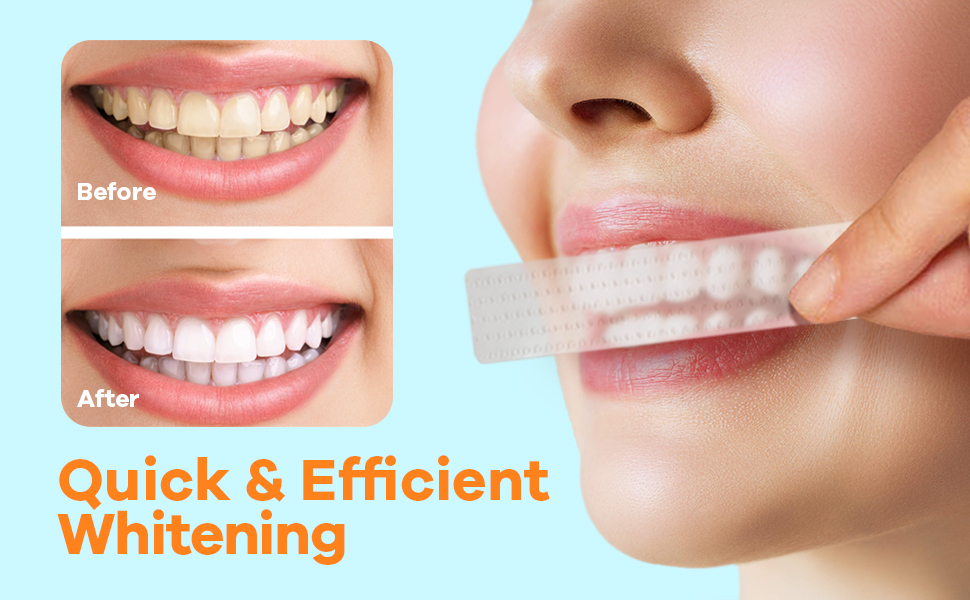 Amazon.com: SmileShark Teeth Whitening Strips 14 Treatments (28-Strips ...