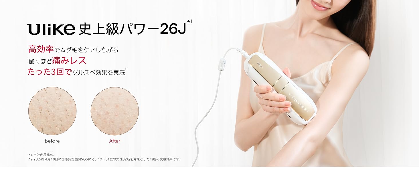 Amazon | 【正規品】Ulike 脱毛器 Air10 光美容器 髭/脇/VIO/脚/腕 全身対応可能 週に3回で効果実感 【メーカー2年保証/特許取得済みサファイア冷却技術でほぼ無痛 ...