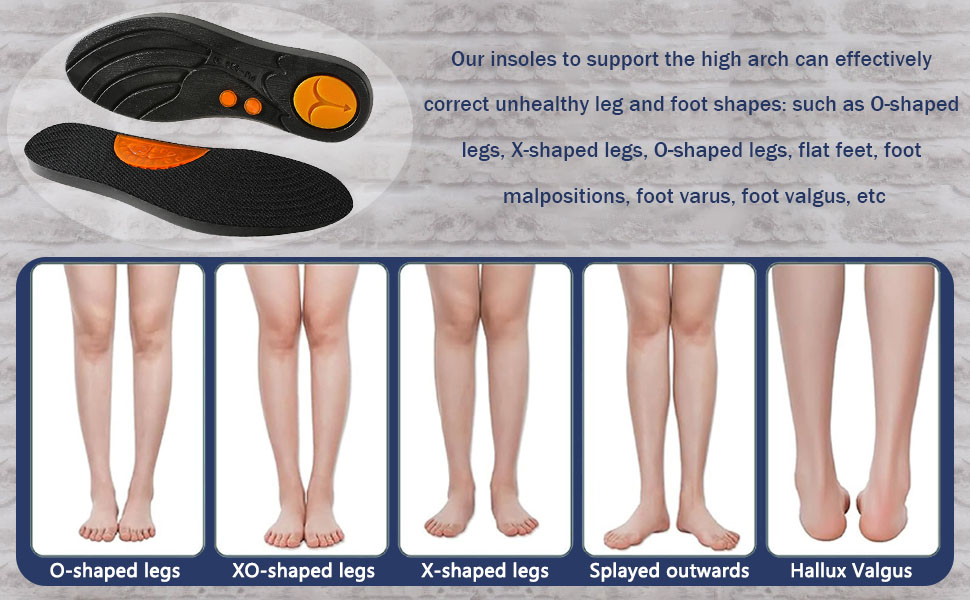 Amazon.com: Supination Insoles for Men and Women-Adjustable Arch Support,Orthotic Corrective ...