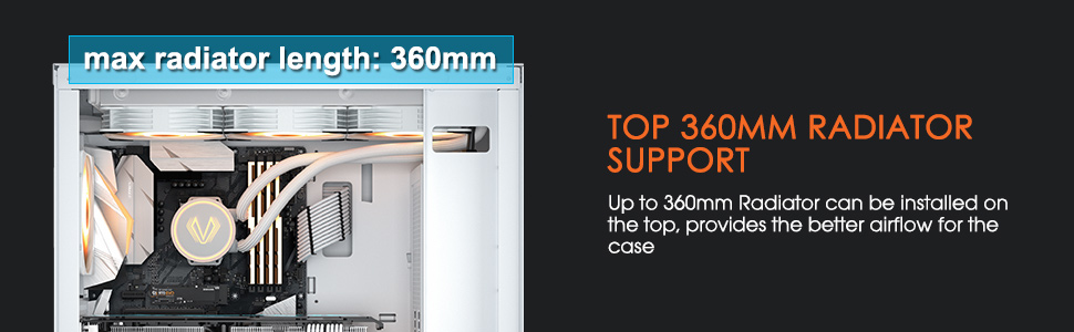 Vetroo AL-MESH-7C Compact ATX PC Case, Front Power Supply, Top 360mm ...