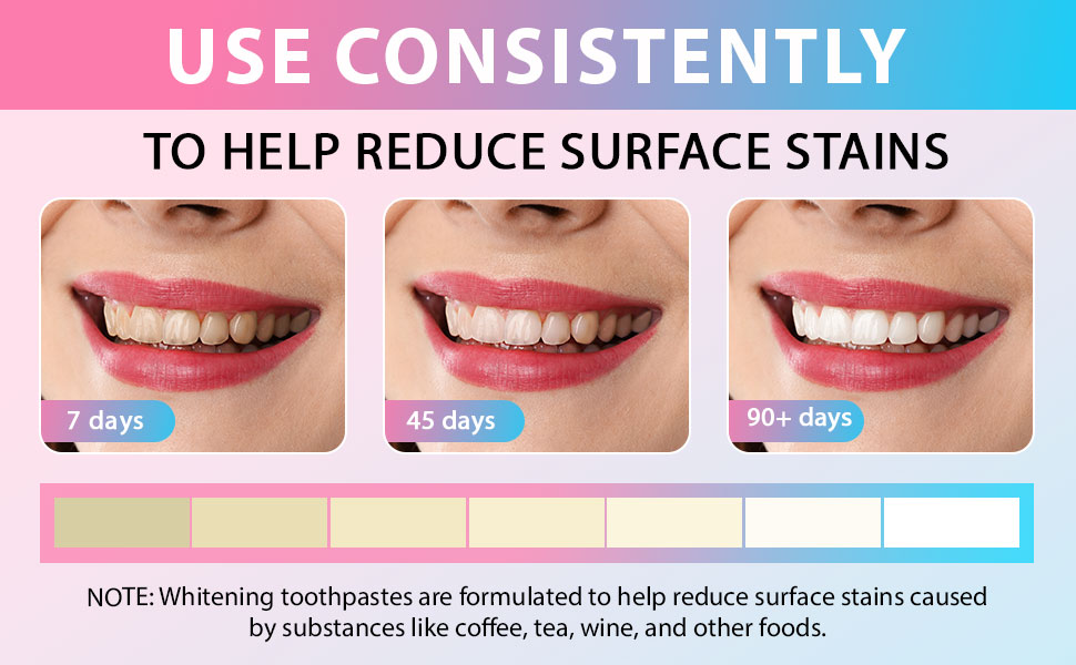 Amazon.com: Niacinamide Whitening Toothpaste, Niacinamide Intensive Toothpaste, Fresh Breath ...