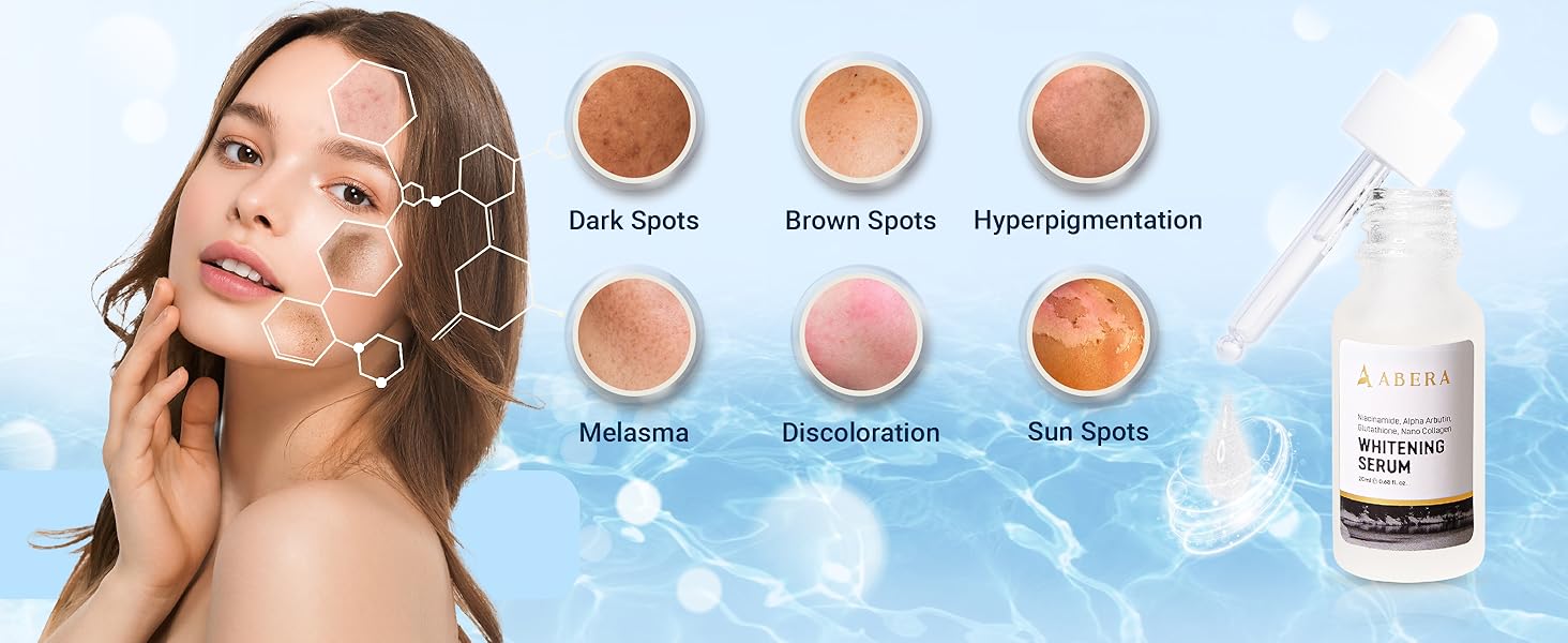 Amazon.com: Abera Dark Spot Corrector for Face, Serum for Dark Spot, Melasma & Hyperpigmentation ...