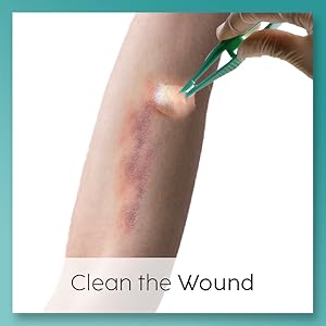 Amazon.com: Elleirb Water-Resistant Island Dressing 4x10, Large Non-Stick Pads w/Adhesive Border ...