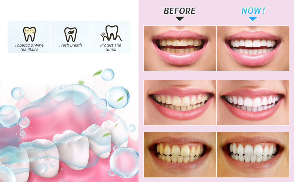 Amazon.com : Niacinamide Toothpaste - Niacinamide Whitening Toothpaste - Niacinamide Intensive ...