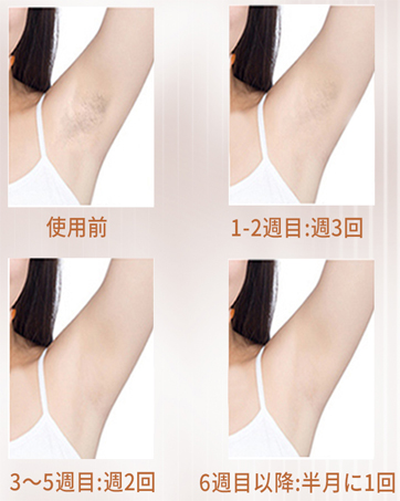 Amazon | TOMONAU 脱毛器 家庭用脱毛器 メンズ レディース 脱毛器vio対応 PSE認証日本正規品 顔 脇 髭 無痛冷感脱毛器 5つの専用モード 5段階調節 手動/自動モード ...