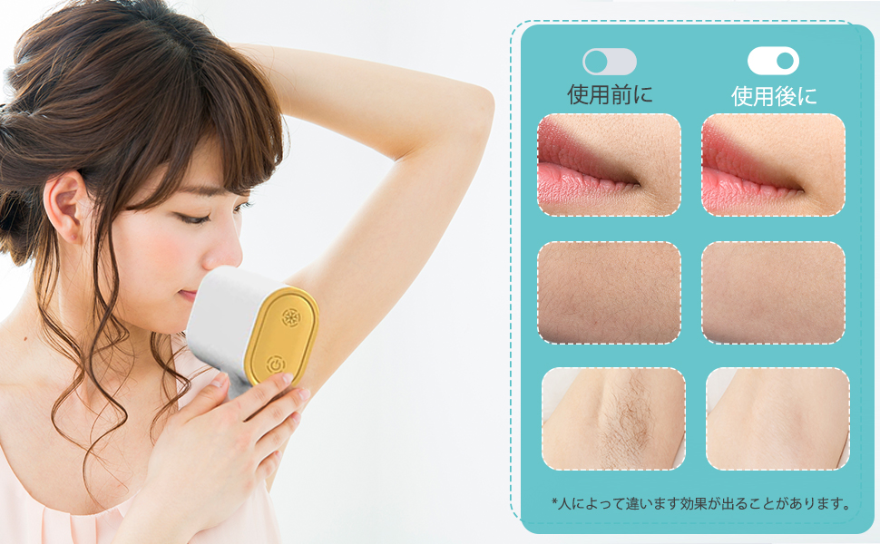 Amazon | GERCY 家庭用脱毛器 IPL 冷感脱毛器 99万発照射 5段階照射 だつもうき脱毛器 光脱毛器 vio対応 光エステ 髭 全身適用 男女兼用 PSE安全認証済み 新年 ...