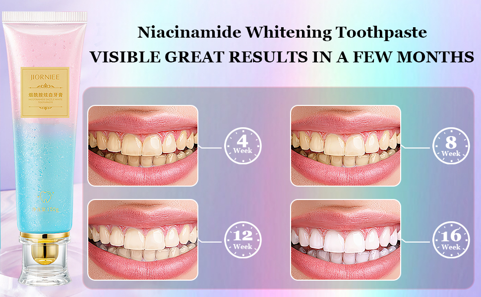 Amazon.com: 2 PCS Niacinamide Toothpaste, Niacinamide Whitening Toothpaste, Whitening Toothpaste ...