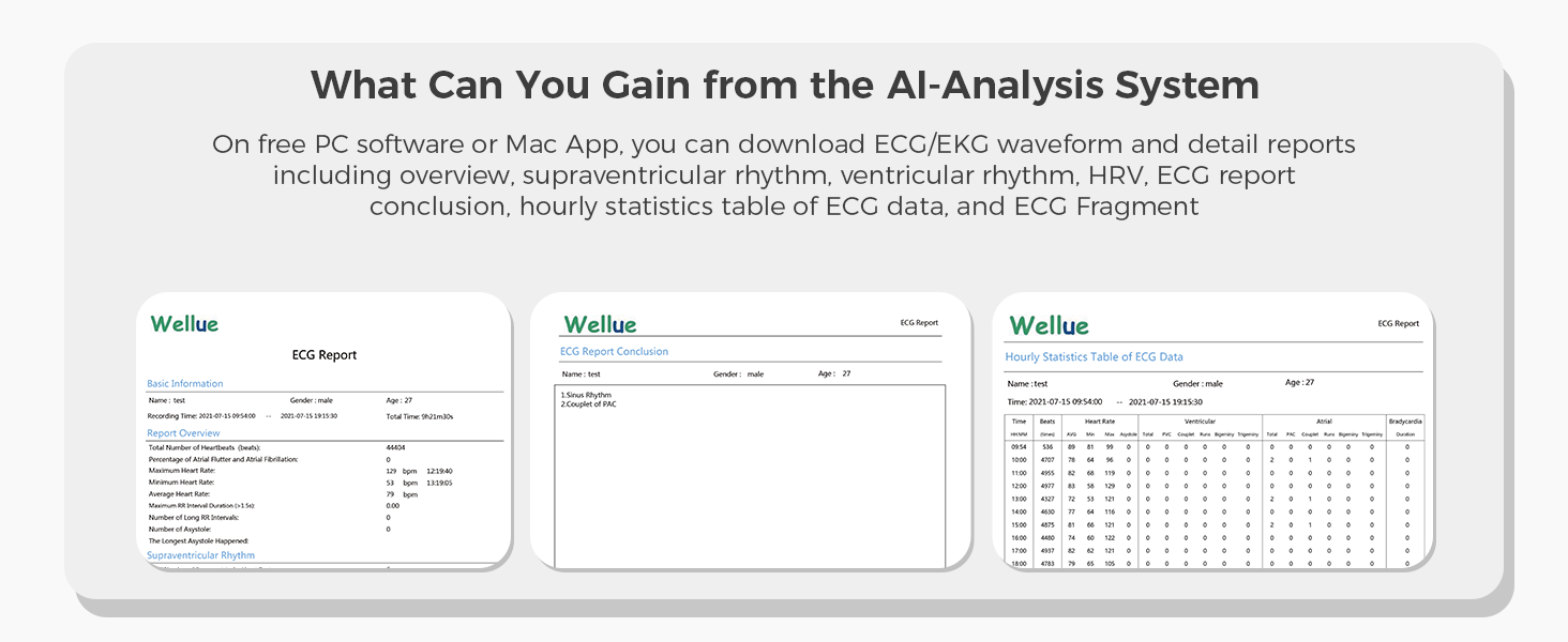 Wellue ER1-LW 24 Hour Wearable ECG Monitor for Home Use, AI ECG Analysis Holter ECG with OLED ...