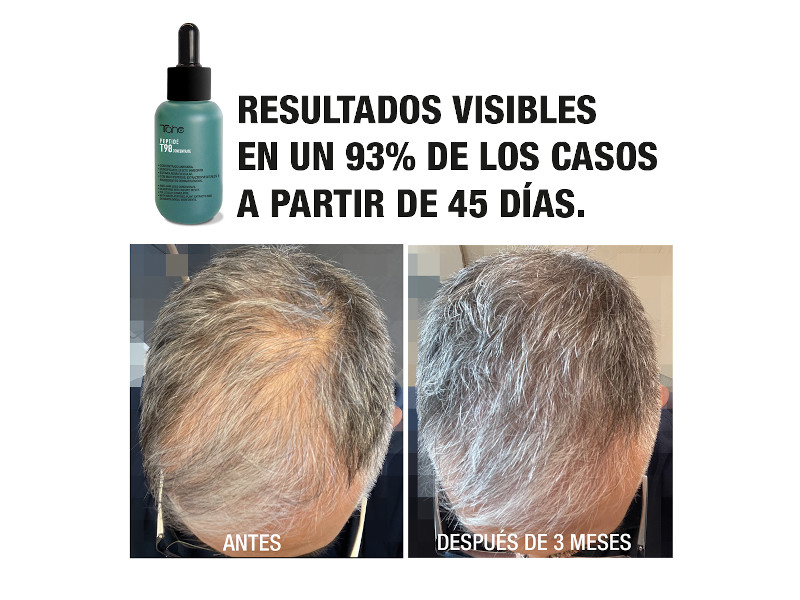 Tahe Peptide T98 Tratamiento concentrado anticaída capilar densificante con multipéptidos de ...