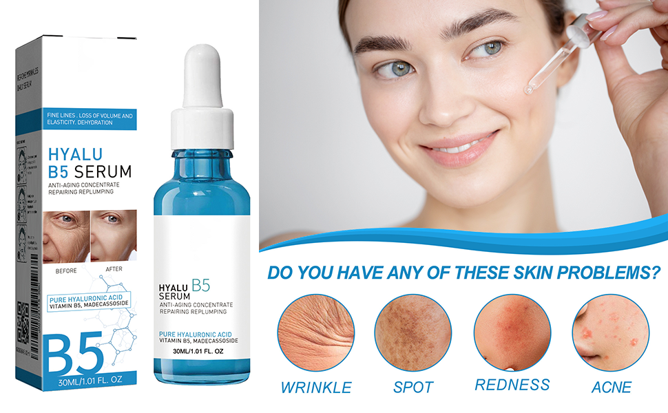 Amazon.com: Hyalu B5 Serum, Botox Face Serum, Botox in a Bottle Instant Face Tightening, Anti ...