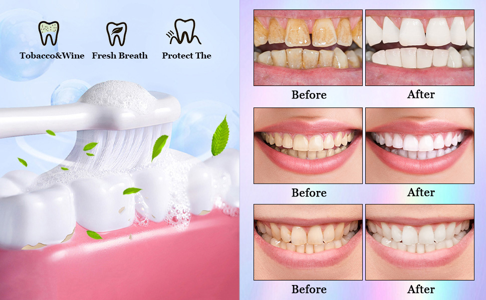 Amazon.com : Niacinamide Whitening Toothpaste, Niacinamid Toothpast, Complete Care Toothpaste ...