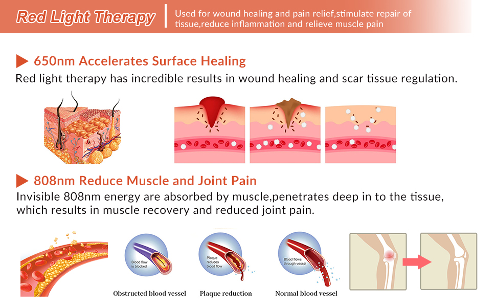 Amazon.com: Handheld Red Light Therapy Device 4x808nm+16x650nm Two Wavelengths Near-Infrared ...