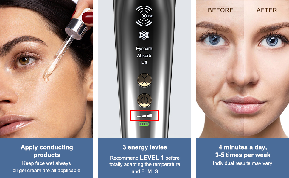 Amazon.com: LEFAY Face Skin Tightening Machine - RF Radio Frequency Facial Device Massager ...