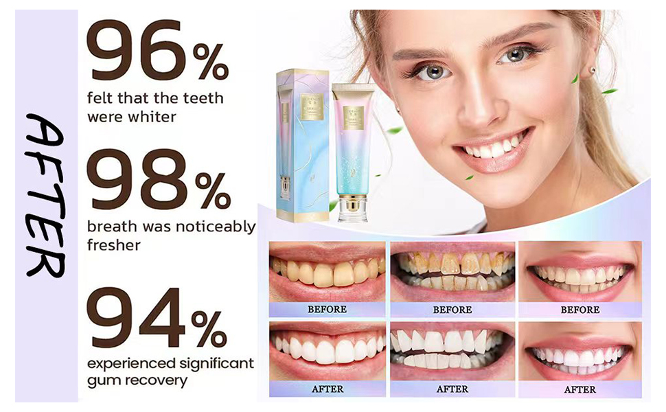 Amazon.com: Niacinamide Toothpaste, Niacinamide Whitening Toothpaste, Fresh Breath, Remove Tooth ...