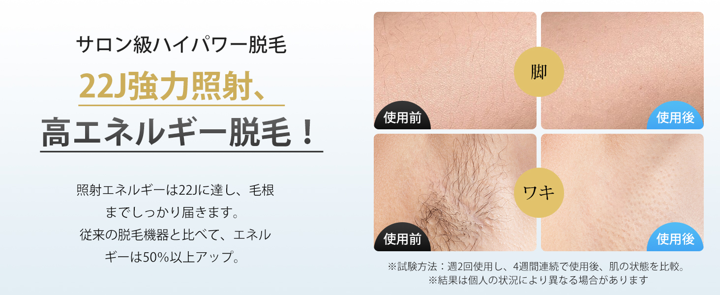 Amazon.co.jp: Clyrox 脱毛器 VIO対応【2025年夏新モデル・IPL・サファイア冷却技術でほぼ無痛】99万回照射 5段階調節 手動/自動照射切替 美肌 顔 体 VIO ...