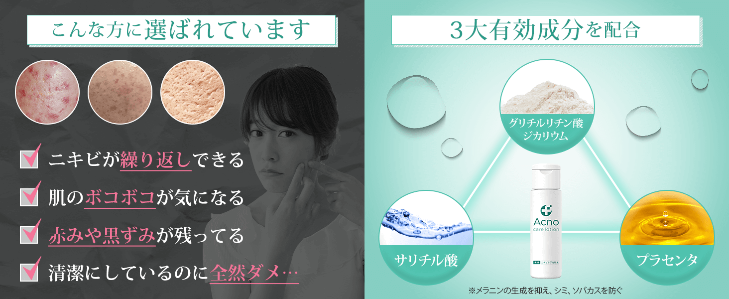 Amazon | ニキビ ニキビケア ニキビ跡 化粧水 薬用 ACNO （ アクノ ）3大有効成分配合 にきび シミ に 男女兼用 全身使用可能 医薬部外品 150ml (1個) | ACNO ...
