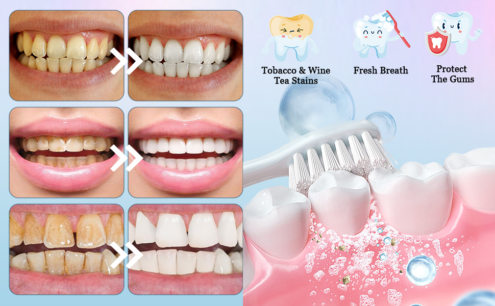 Amazon.com : 2Pcs Acssart Radiant Whitening Toothpaste,Unismart Toothpaste Whitening,Niacinamide ...