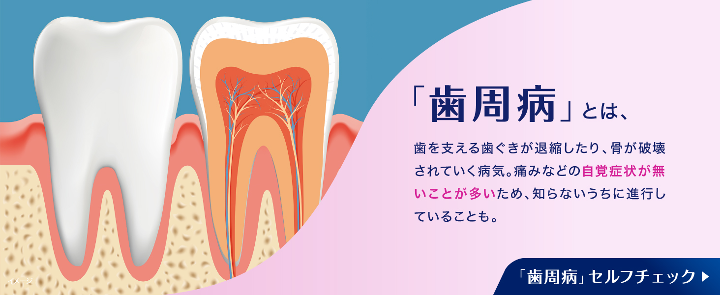 Amazon | 【医薬部外品】シュミテクト 歯周病ケア+口臭予防歯磨き粉 知覚過敏ケア 高濃度フッ素配合 〈1450ppm〉2本+歯周ケア歯ブラシ【お得セット】 | シュミテクト | 大人用 ...