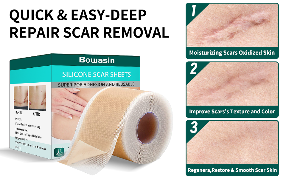Silicone Scar Sheets (1.6'' x 60''Roll-1.5M) Silicone Scar Tape ...