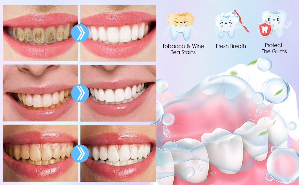 Amazon.com : Acssart Radiant Whitening Toothpaste, Niacinamide Whitening Toothpaste, Niacinamide ...