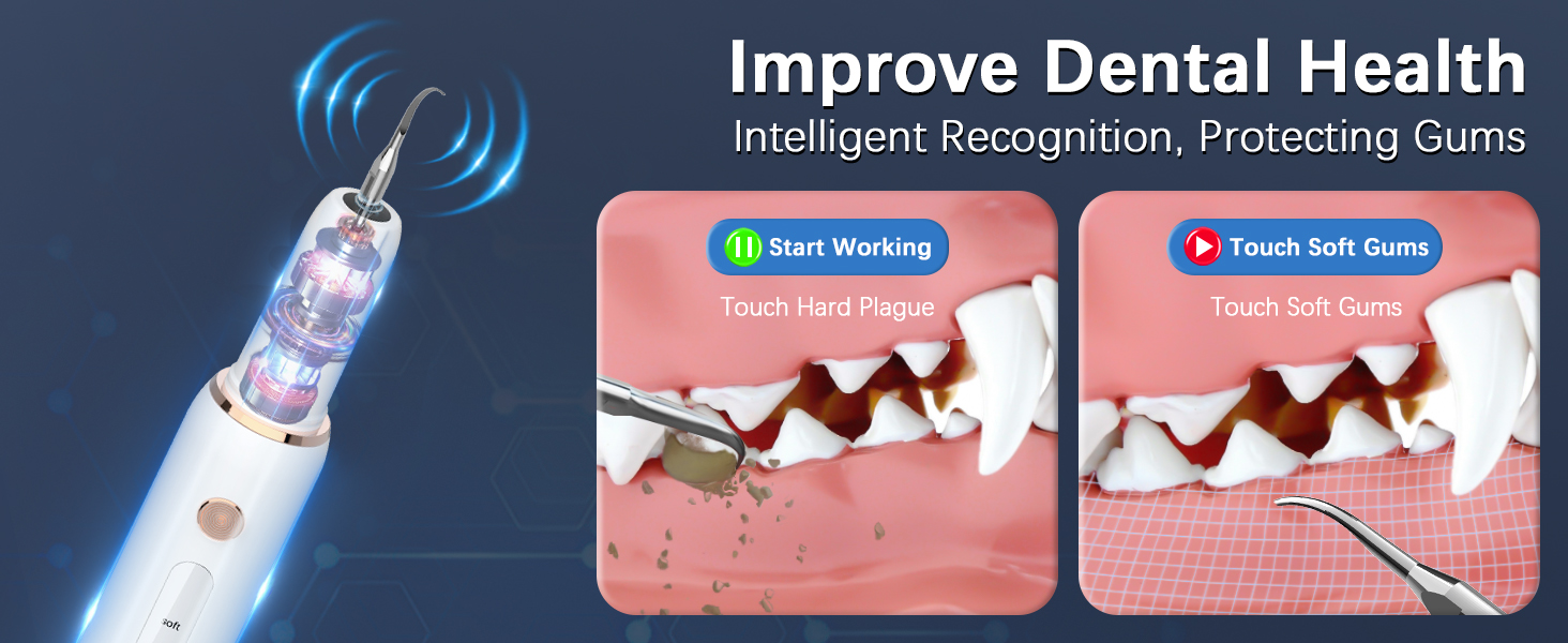 Amazon.com : Wrischan Tartar Remover for Teeth, Electric Plaque Remover ...