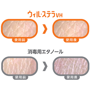 Amazon.co.jp: サラヤ 速乾性手指消毒剤 ウィル・ステラVH 5L 詰替ノズル付 【指定医薬部外品】 42340 : ドラッグストア