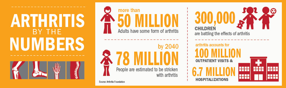 Amazon.com: Basic Care Arthricream, Trolamine Salicylate 10%, Analgesic ...